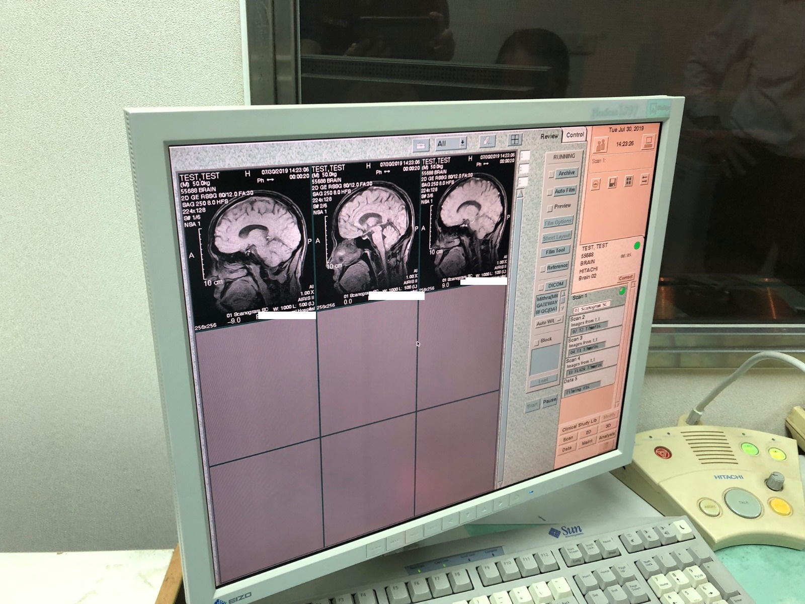 Used Hitachi Medical Systems AIRIS II 0.3T MRI Scanner