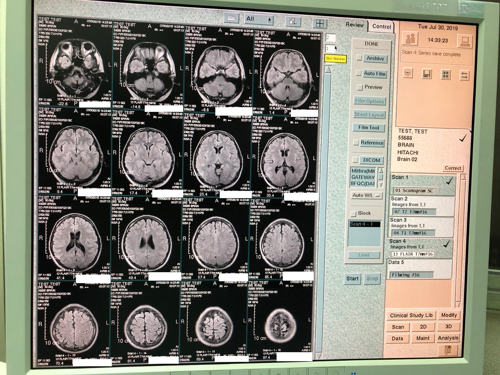 Used Hitachi Medical Systems AIRIS II 0.3T MRI Machine