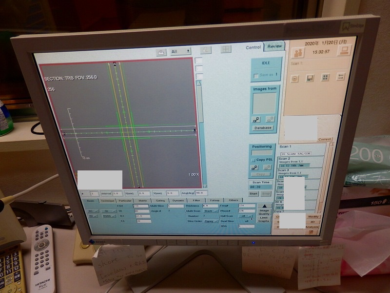 Used Hitachi Airis Elite MRI for Sale | 20Med