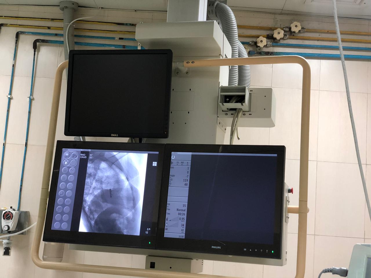 Used Philips Allura Xper FD 20 Cath Lab for Sale | 20Med