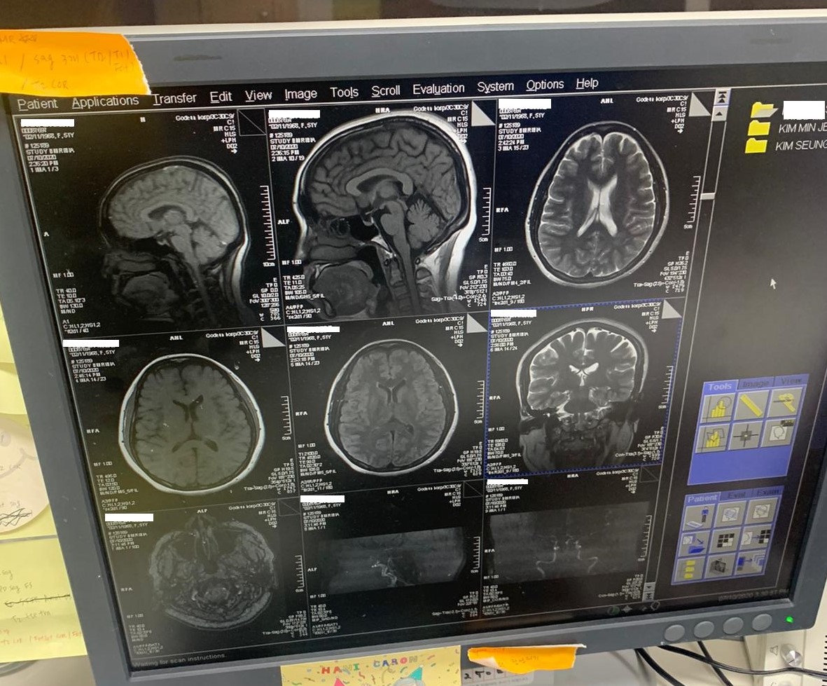 Refurbished Siemens Healthcare MAGNETOM C 0.35T MRI Scan
