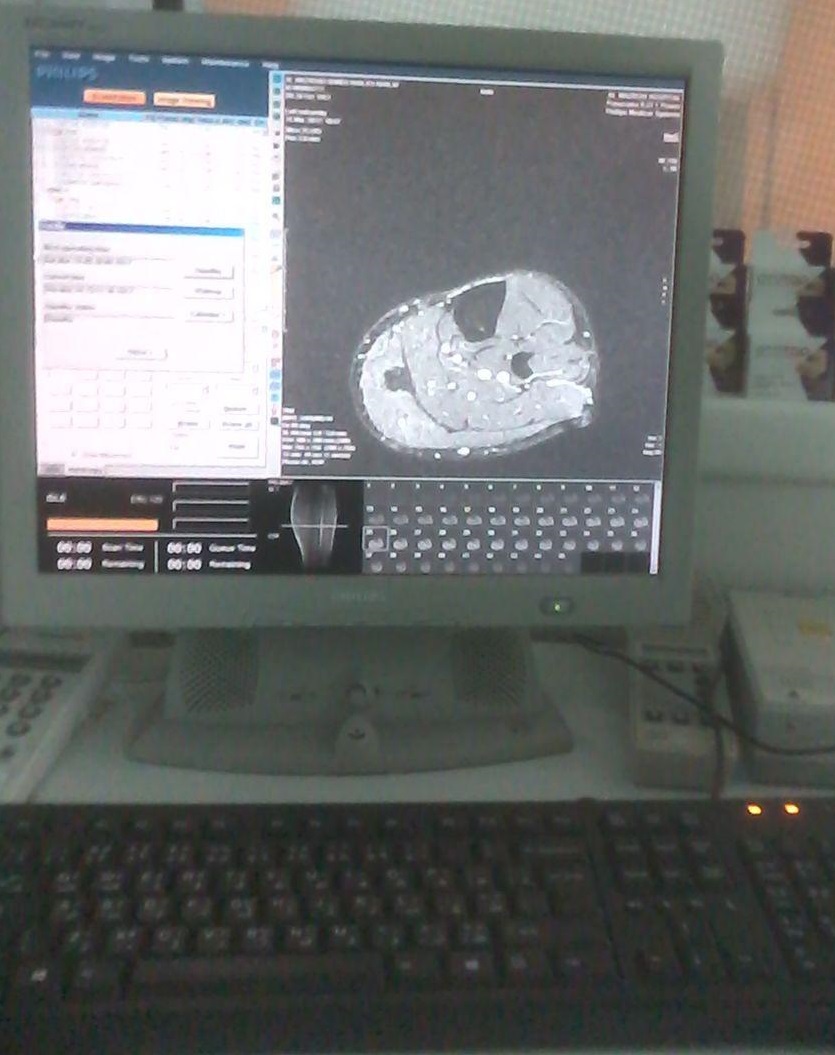 Used Philips Healthcare Panorama 0.23T MRI Scanner