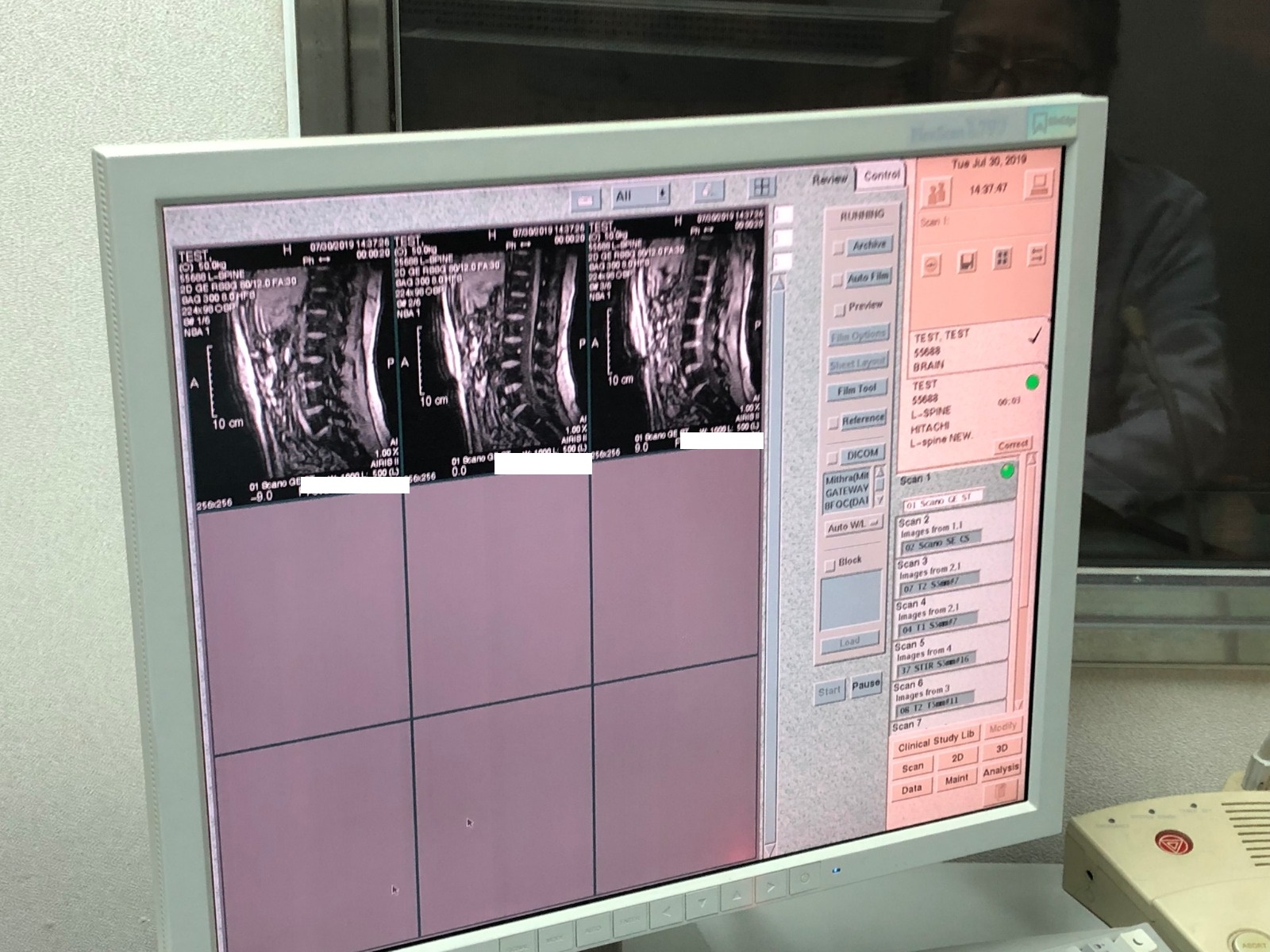 Used Hitachi Medical Systems AIRIS II 0.3T MRI Scan