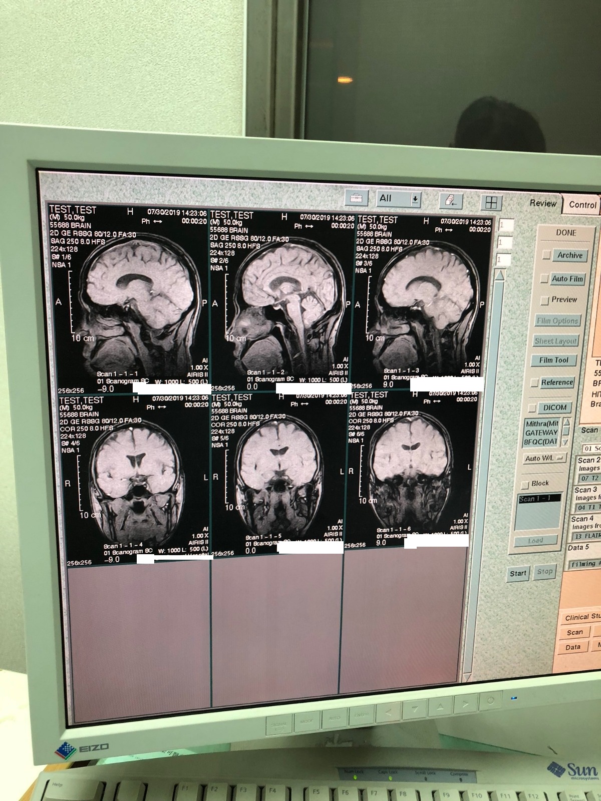Refurbished Hitachi Medical Systems AIRIS II 0.3T MRI Scan