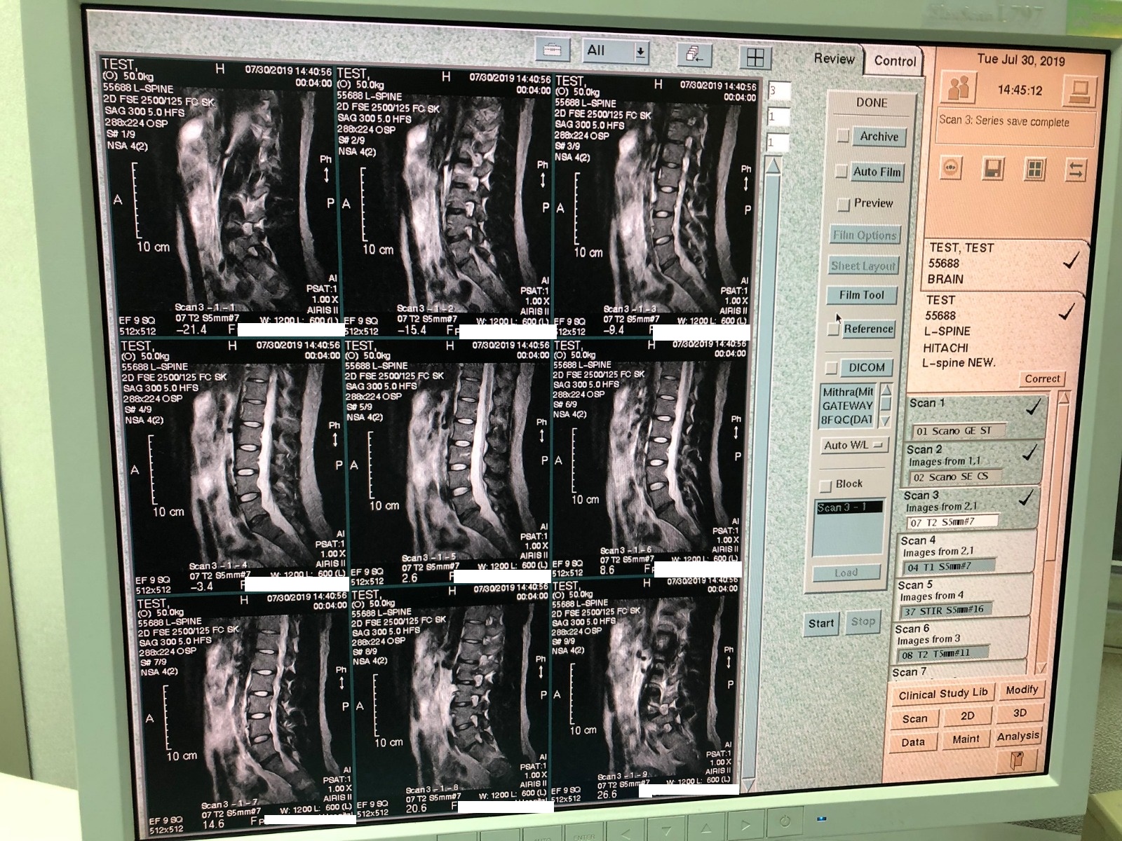 Used Hitachi Medical Systems AIRIS II 0.3T MRI Machine